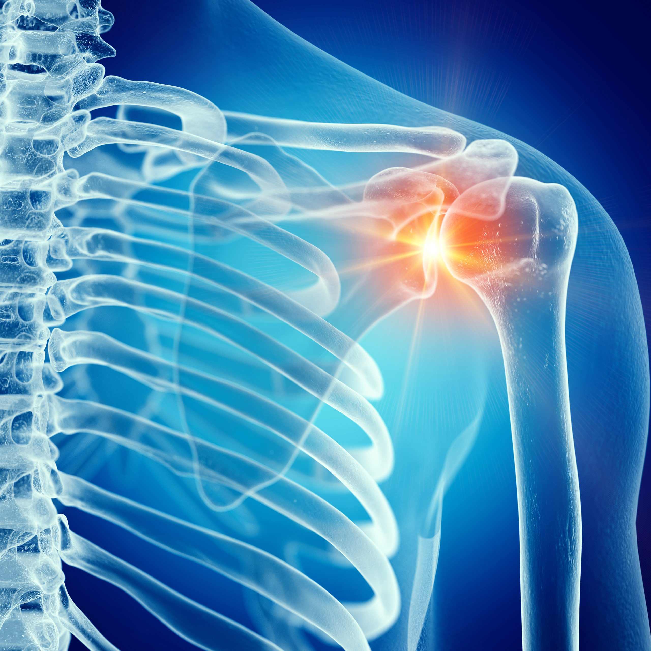 Shoulder - Southeast Kansas Orthopedic Clinic